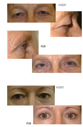 Dr. Cambier: plastische, esthetische en reconstructieve heelkunde